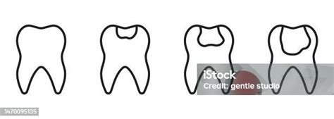 치아 우식증 프로세스 라인 아이콘 세트입니다 치과 충전 기호입니다 교정 치아 문제 치아 질환 단계 선형 픽토그램 치과 개요 기호입니다 편집 가능한 획 고립된 벡터 그림 건강