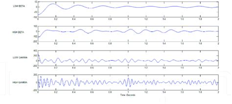 First Plot Shows Original Signal Followed By Segmented Eeg Seizure