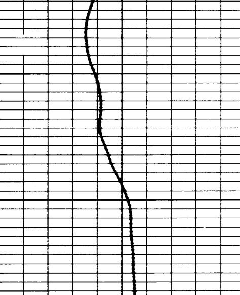 curve extraction instance segmentation dataset by welllog