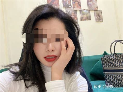 牙丑也会传染？苏州牙齿矫正我想说。。 知乎