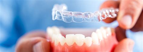 Invisalign Waterdown Invisalign Dentist Waterdown Waterdown Village