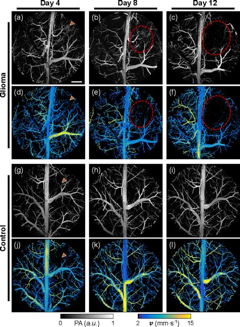 Figure 3 From High Spatiotemporal Mapping Of Cortical Blood Flow