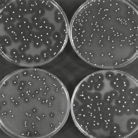 Pdf Bacteriocins From Lactic Acid Bacteria