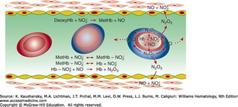 Methemoglobinemia And Other Dyshemoglobinemias Oncohema Key