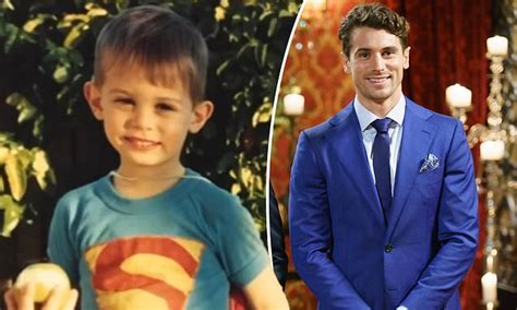 The Bachelors Matty J Johnson Makes Shock Cosmetic Surgery