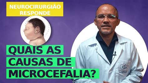 Principais Causas De Microcefalia Neurocirurgião Responde Youtube