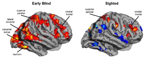 Neural Correlates Revealed By Fmri Associated With Tactile Symmetry