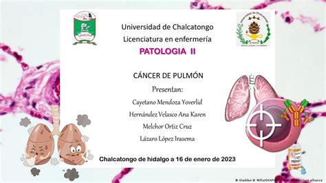 Cáncer de pulmón Ana Karen uDocz