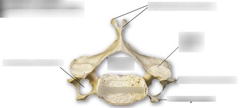 Typical Cervical Vertebra Diagram Quizlet