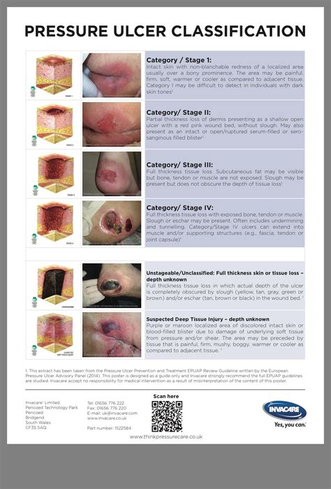 Wound Care For Stage Ii Pressure Ulcer At Michael Huffman Blog