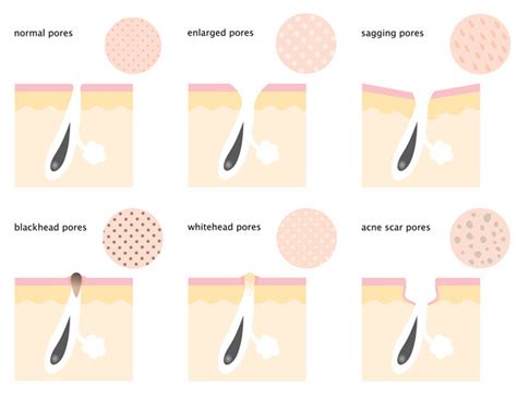 Simple Habits That Help Minimize Your Pores WorthvieW