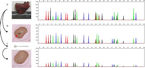 Innovations In Forensic Sciences For Human Identification By Dna In The French Gendarmerie