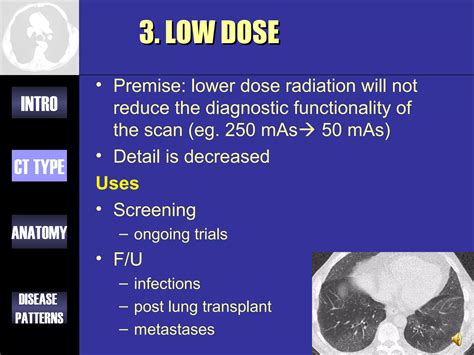 Approach To Ct Chest 578 Ppt
