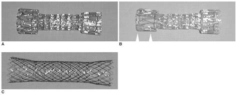 Interventional Management Of Malignant Colorectal Obstruction Use Of