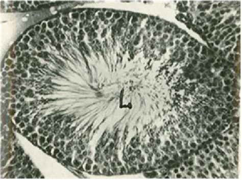Cross Sections Of Testes Showing Normal Histology With Lumen Filled