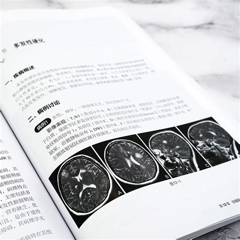 中枢神经系统mri和ct诊断图解修建军中枢神经系统常见疾病影像学特点及鉴别诊断书籍先天性疾病颅脑损伤脑卒中血管性病变影像医学虎窝淘