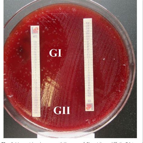 The Api 20 Ne Biomérieux Is A Commercial Biochemical Identification Download Scientific