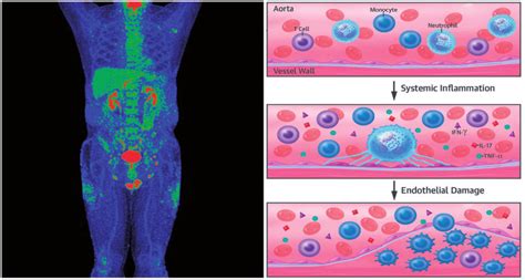Fused 18 F Fluorodeoxyglucose Positron Emission Tomography Computed Download Scientific Diagram
