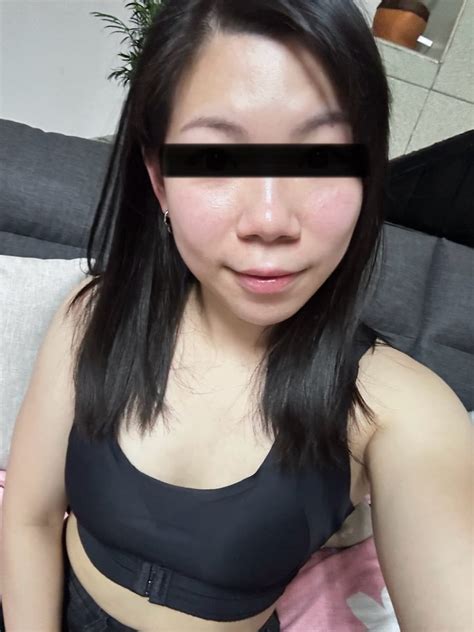 詢問 有姐妹這樣嗎？ 醫美板 Dcard