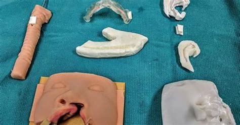 Surgeons Use 3d Printing To Make Practice Perfect