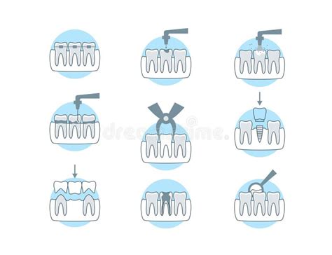 Tandheelkundige Procedure Klinische Kleur Dun Lijnpictogram Ingesteld
