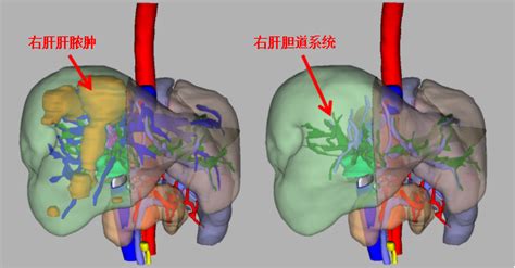 复杂胆道术后患者千里寻医 哈医大一院肝脏微创外科团队巧解难题哈尔滨医科大学附属第一医院专家介绍科室