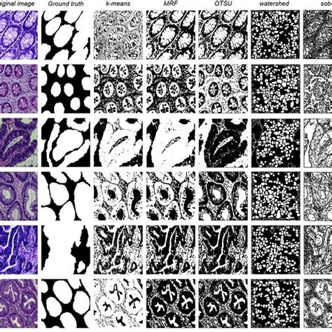 five types of data segmentation results obtained by different classical