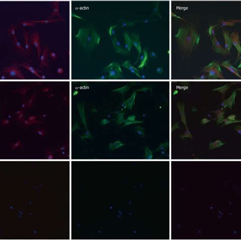 Double Immunofluorescence Labeling Of Cystathionine β Synthase And