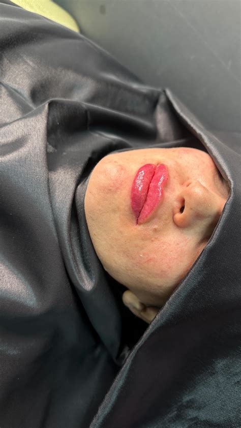 ‎دکتربیتاکارگر‎ ‎ما مثل کلینیک های دیگه عکس روتوش شده نمیذاریم ، لب