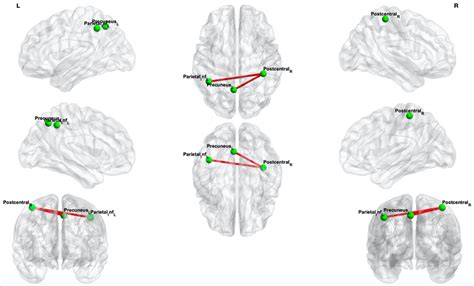 whole brain network based statistics results the connectivity analysis