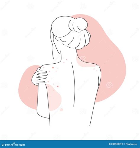 Back View Of Woman Body With Allergic Skin Reaction Stock Vector