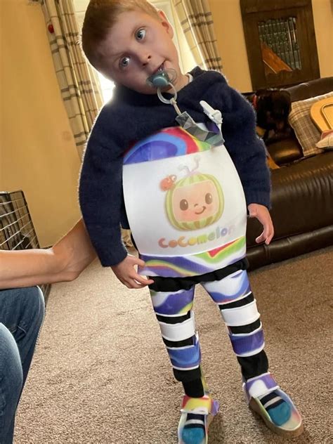 Seth Age 4 Stands For The First Time Thanks To An Orthotic Standing
