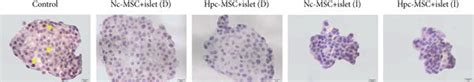P53 Protein Level In Human Islets Cocultured With Hpc MSCs And Nc MSCs