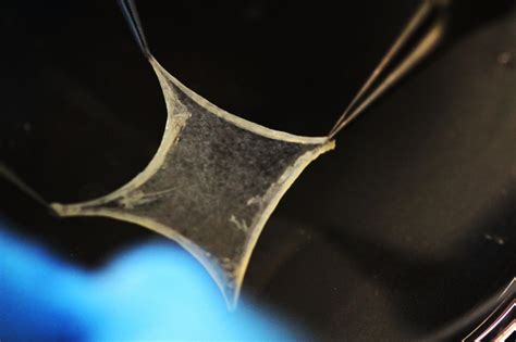 Robotic Endoscopic Platform For Performance Of Advanced Endoluminal Surgery Innovation Hub Hk