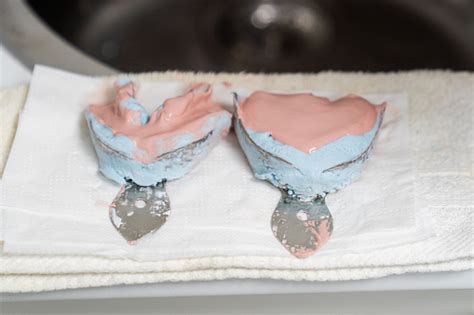 치아 정렬을 준비하는 성형 재료가 있는 치과 인상 트레이 0명에 대한 스톡 사진 및 기타 이미지 0명 건강관리와 의술 분홍 Istock