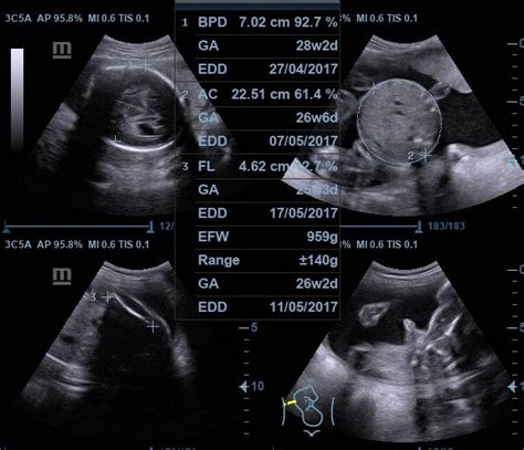 Dokter Kandungan Ku Usg 4 Dimensi Ibu Hamil