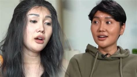 Wajah Bengkak Dan Babak Belur Lucinta Luna Terbaring Lemah Di Rumah
