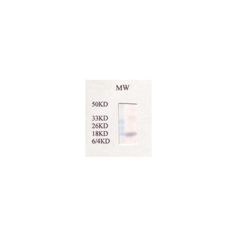 Buy Gfp Antibody Axil Scientific