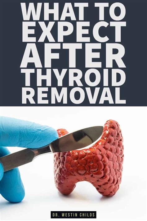 Thyroidectomy Recovery Guide What To Expect After Thyroid Surgery