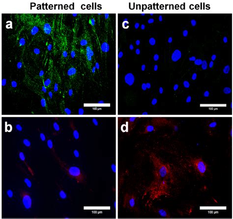 Immunostaining Of B Mhc And Osteocalcin After 21 Days Of Hmscs Culture Download Scientific