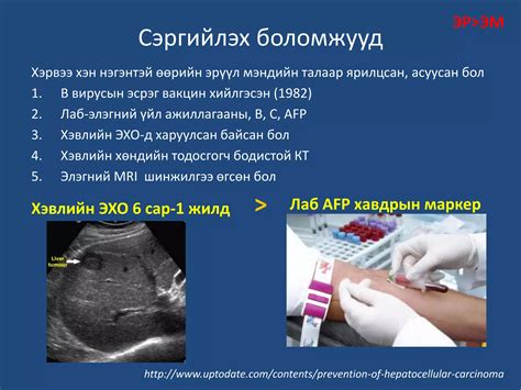 Хавдрын эрт илрүүлэг оношилгоо Ppt