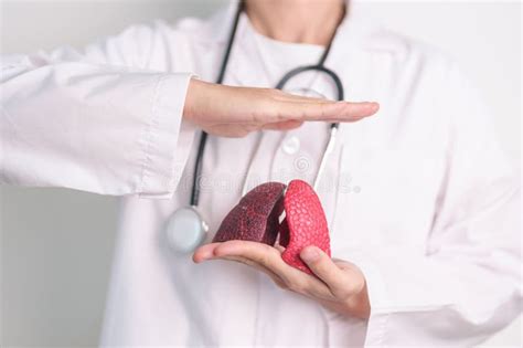 Anatomía Pulmonar De Cobertura Manual Del Médico Cáncer De Pulmón Asma
