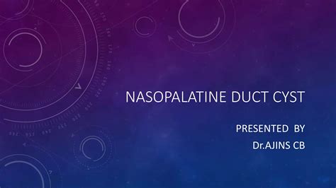 Nasopalatine Duct Cyst Ppt