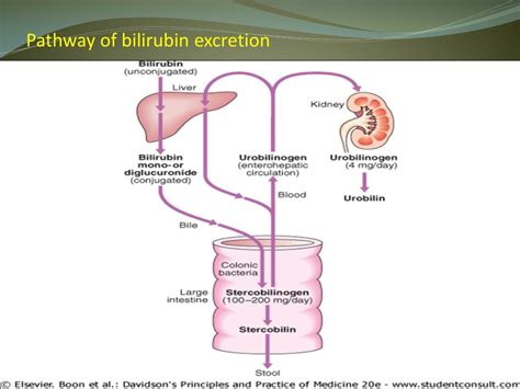 Ppt Jaundice Powerpoint Presentation Free Download Id 455806