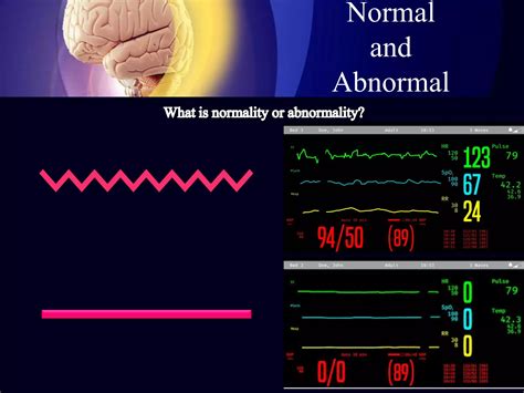 Concept Of Normality And Abnormality Pdf