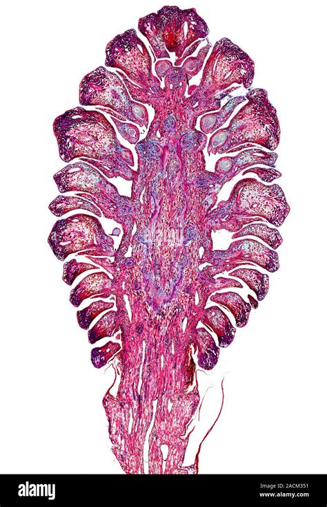Female Pine Cone Light Micrograph Of A Section Through A Young Ovulate