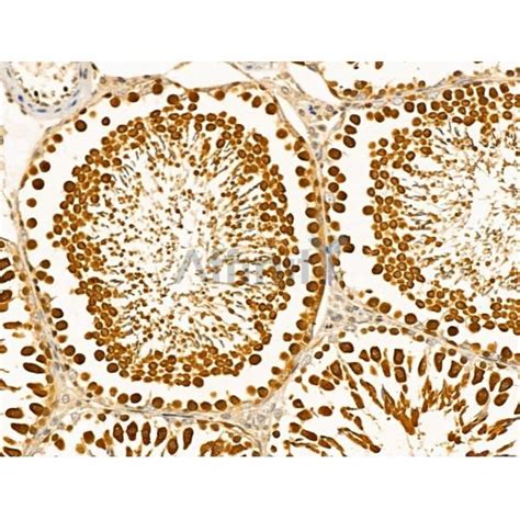 Ddr1 Antibody Affinity Biosciences