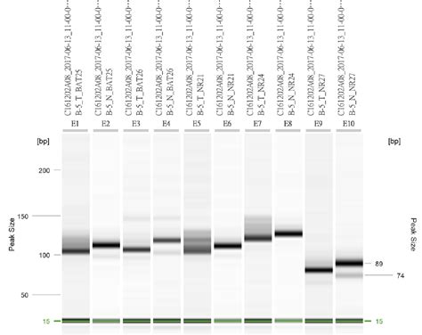 Figure 1 From High Concordance Rate Of Capillary Electrophoresis