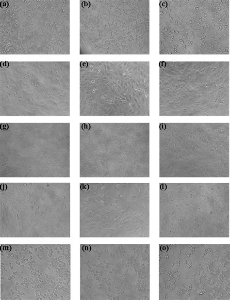 Figure S3 Vero Cell Cytotoxicity Assay For Cdt Representative Images