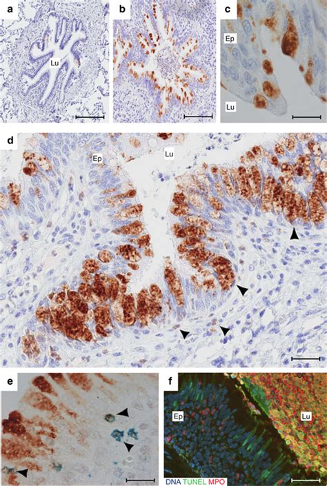 Detection Of CXCL6 Chemokine C X C Motif Ligand 6 And DNA In Small Download Scientific